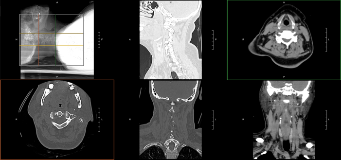Multiple Reference Lines